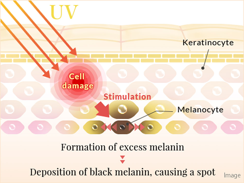 Cinal® L White EXIA | ShionogiHealthcare